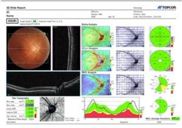 Topcon Maestro2 OCT - Global Medical Equipment Shop